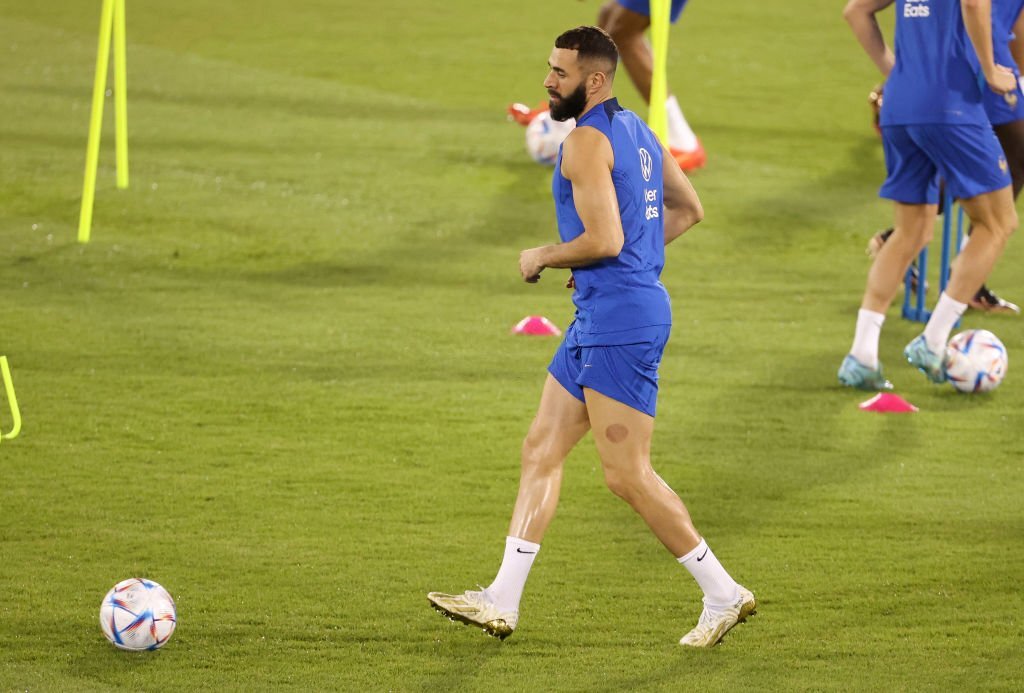 France star Karim Benzema out for World Cup with leg injury | Pakistan ...